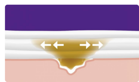 VACUTEX™ - Protex Healthcare